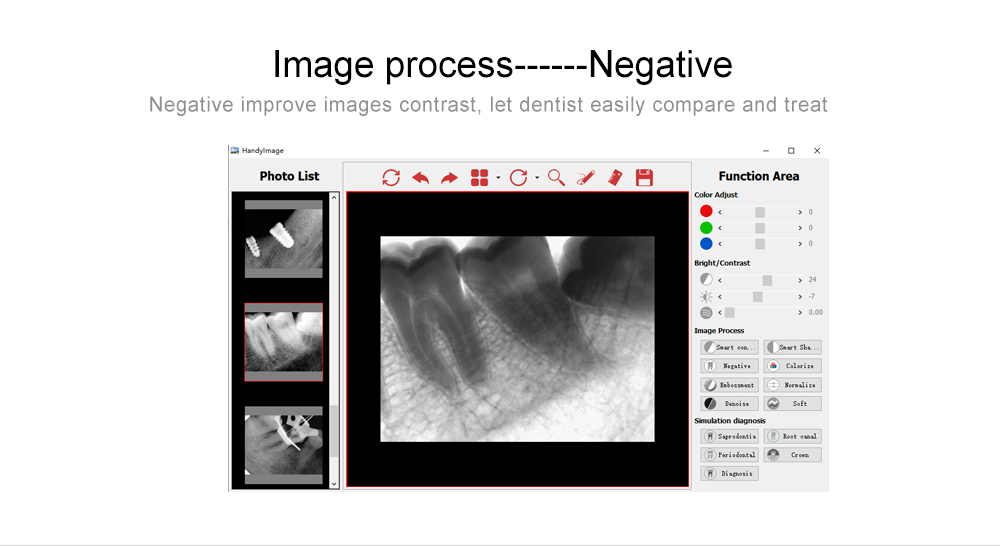 Handy Dentist Imaging Management Software - Welcome to Shanghai Handy ...
