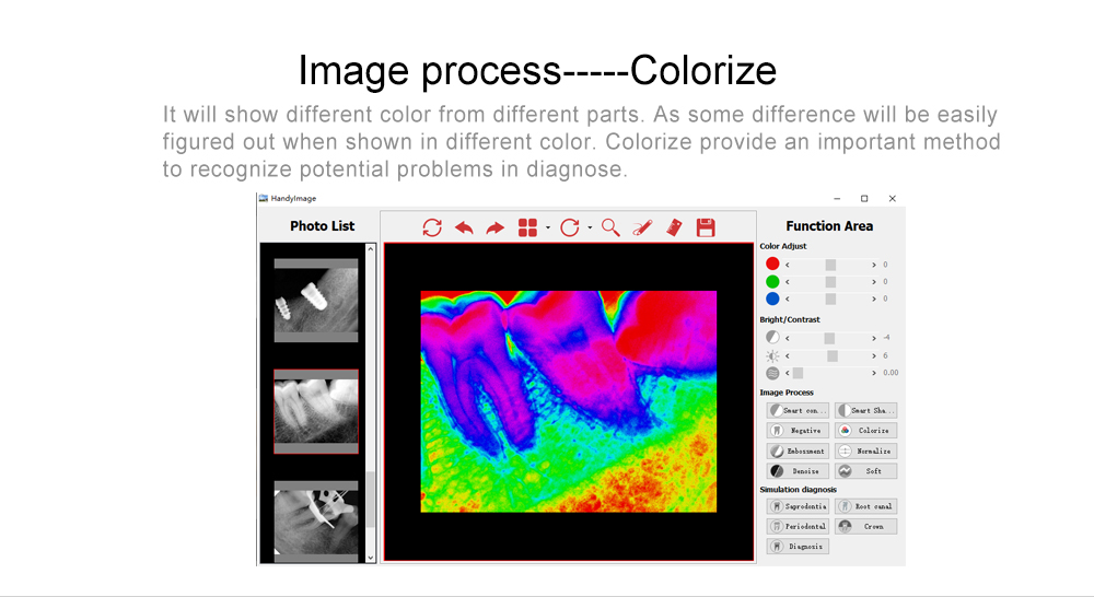 Handy Dentist Imaging Management Software - Welcome to Shanghai Handy ...