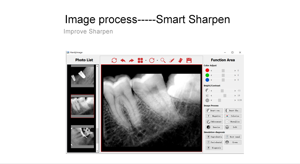 Handy Dentist Imaging Management Software - Welcome to Shanghai Handy ...